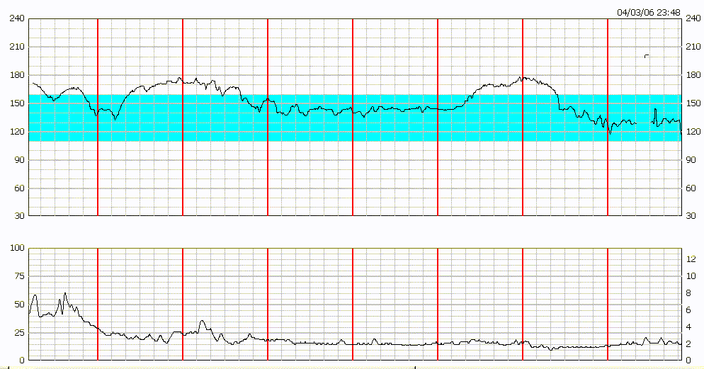 Fetal Tracing Index – Electronic Fetal Monitoring