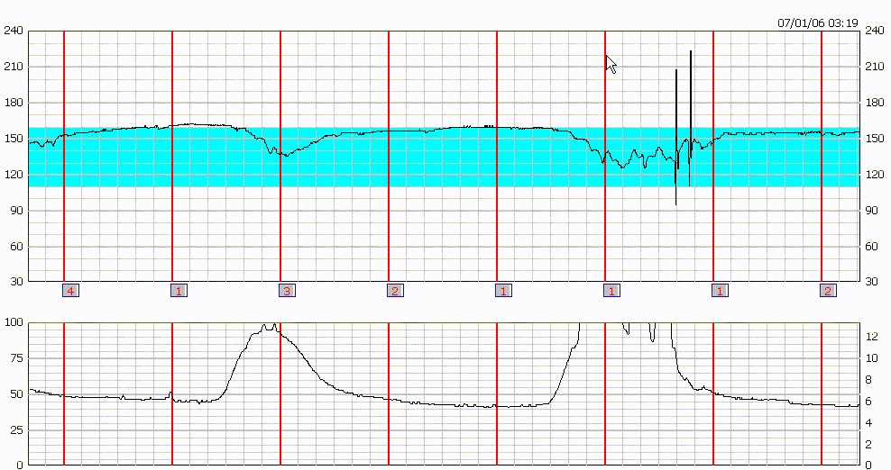 Fetal Tracing Index – Electronic Fetal Monitoring