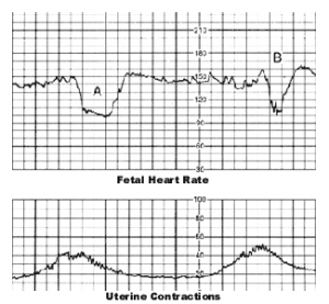 Fetal Monitoring Equipment – Electronic Fetal Monitoring