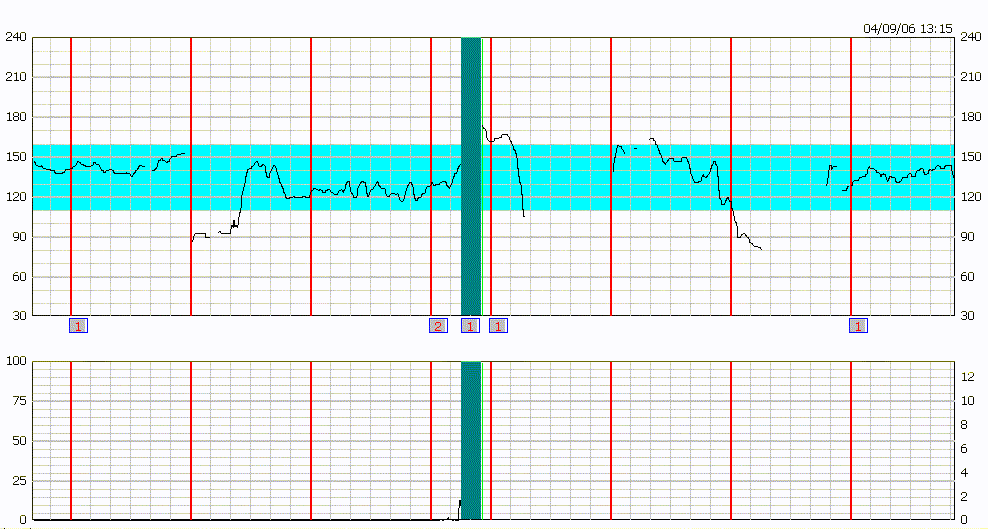 Fetal Tracing Index – Electronic Fetal Monitoring